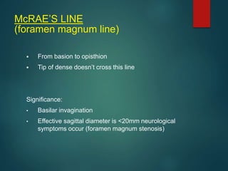 CRANIOVERTEBRAL JUNCTION ANATOMY, CRANIOMETRY, ANAMOLIES AND RADIOLOGY ...