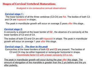 Cvm method | PPT