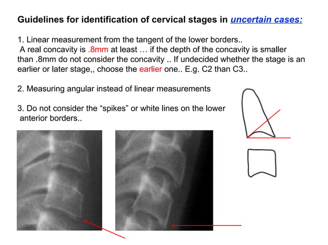 Cvm method | PPT