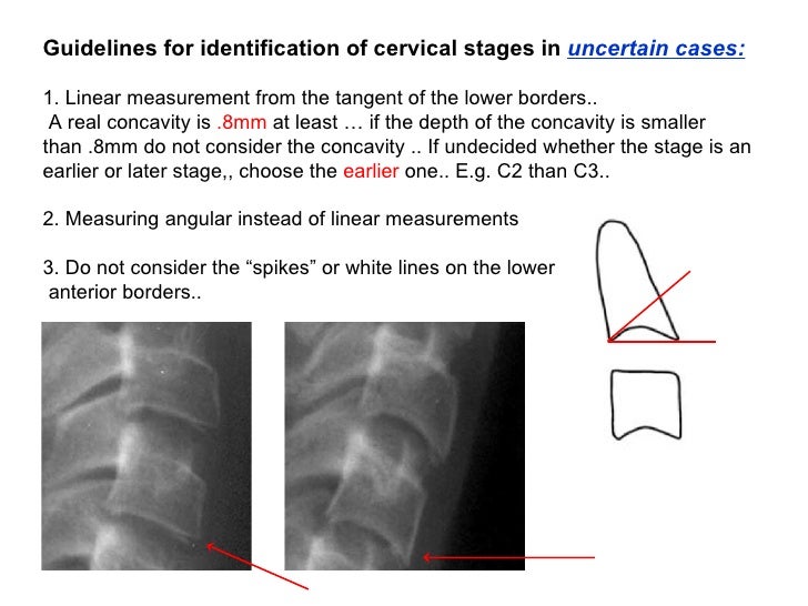 Cvm method