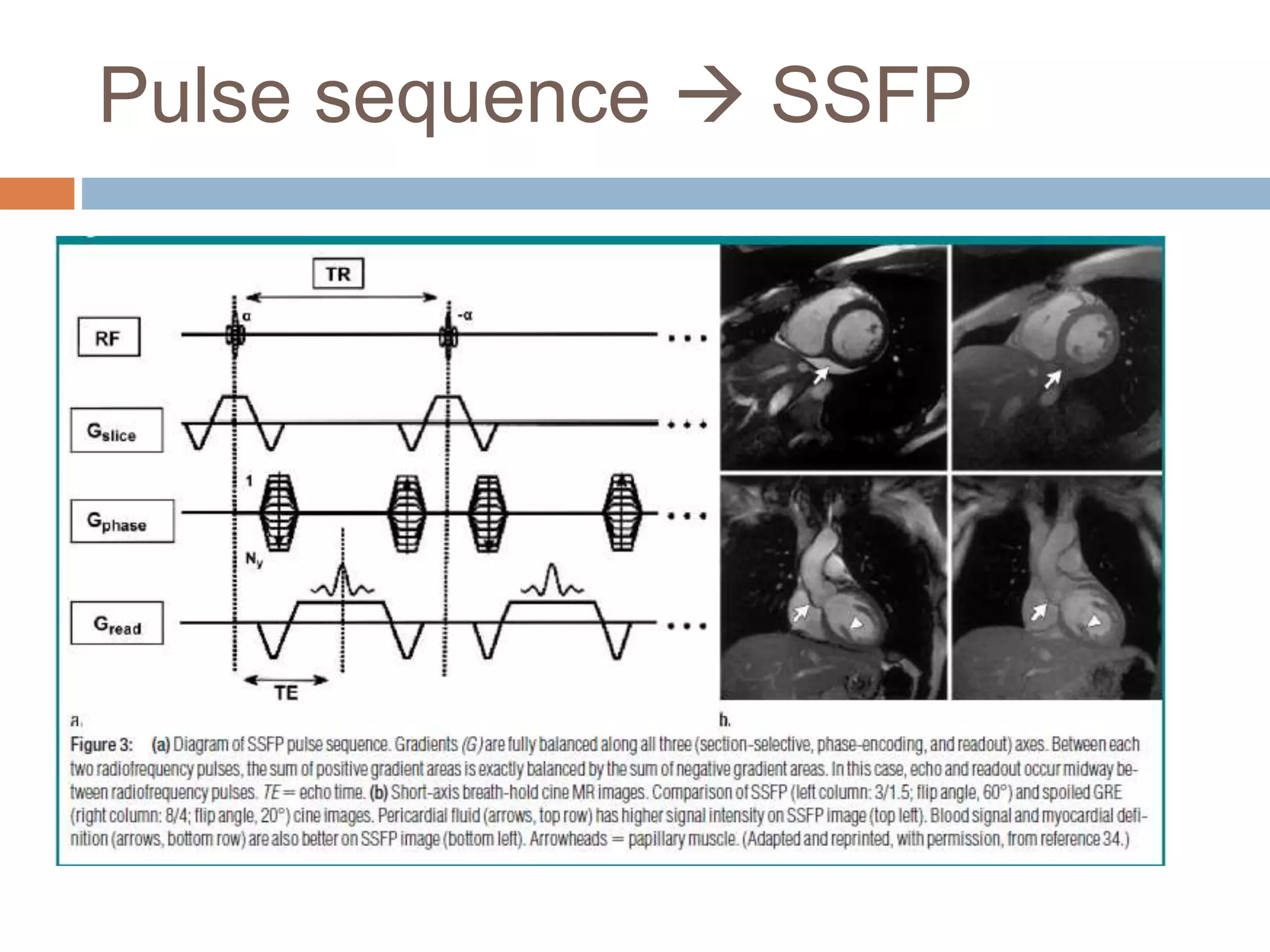 Cardiac MRI principle | PPTX