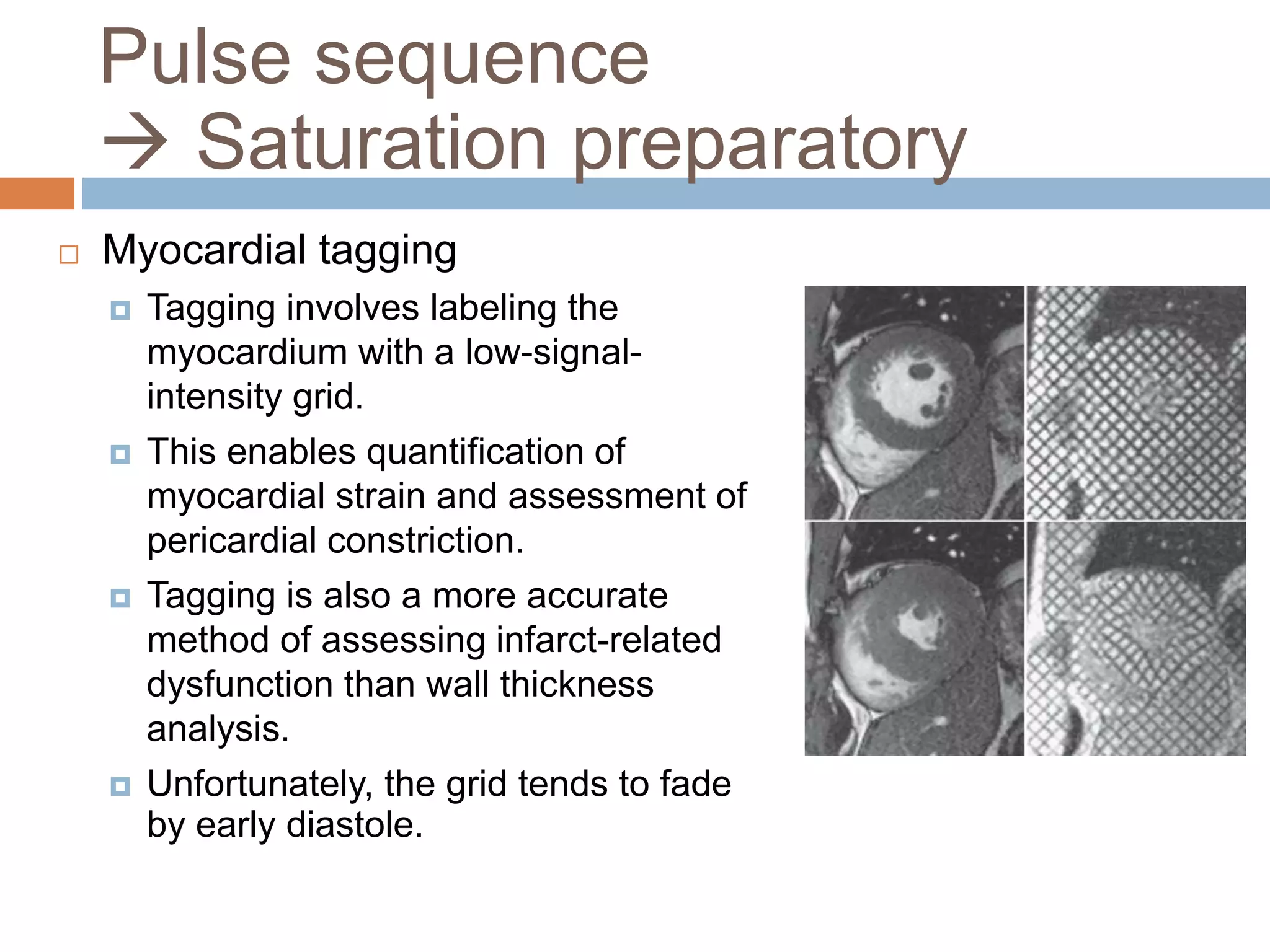 Cardiac MRI principle | PPTX