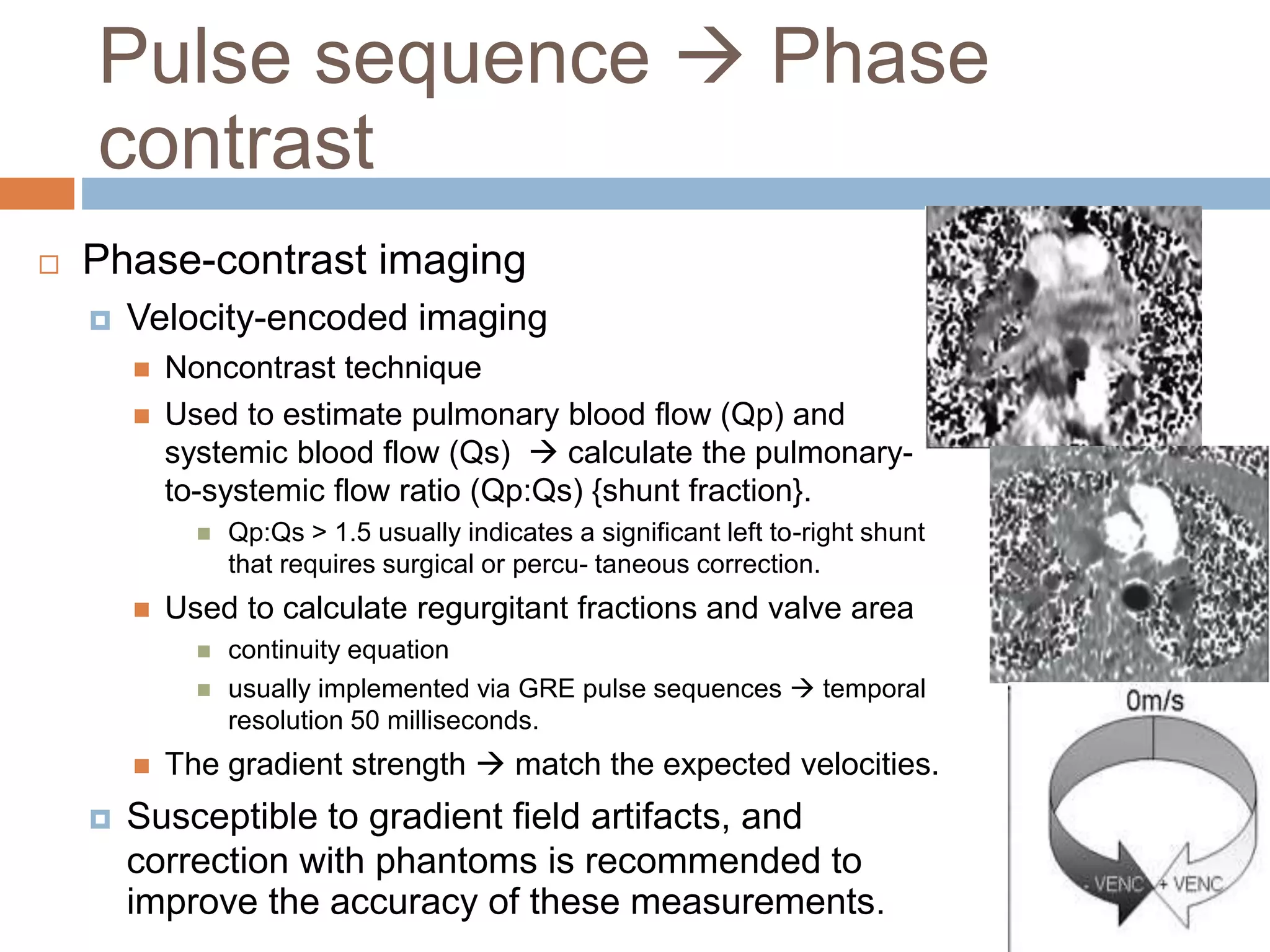 Cardiac MRI principle | PPTX