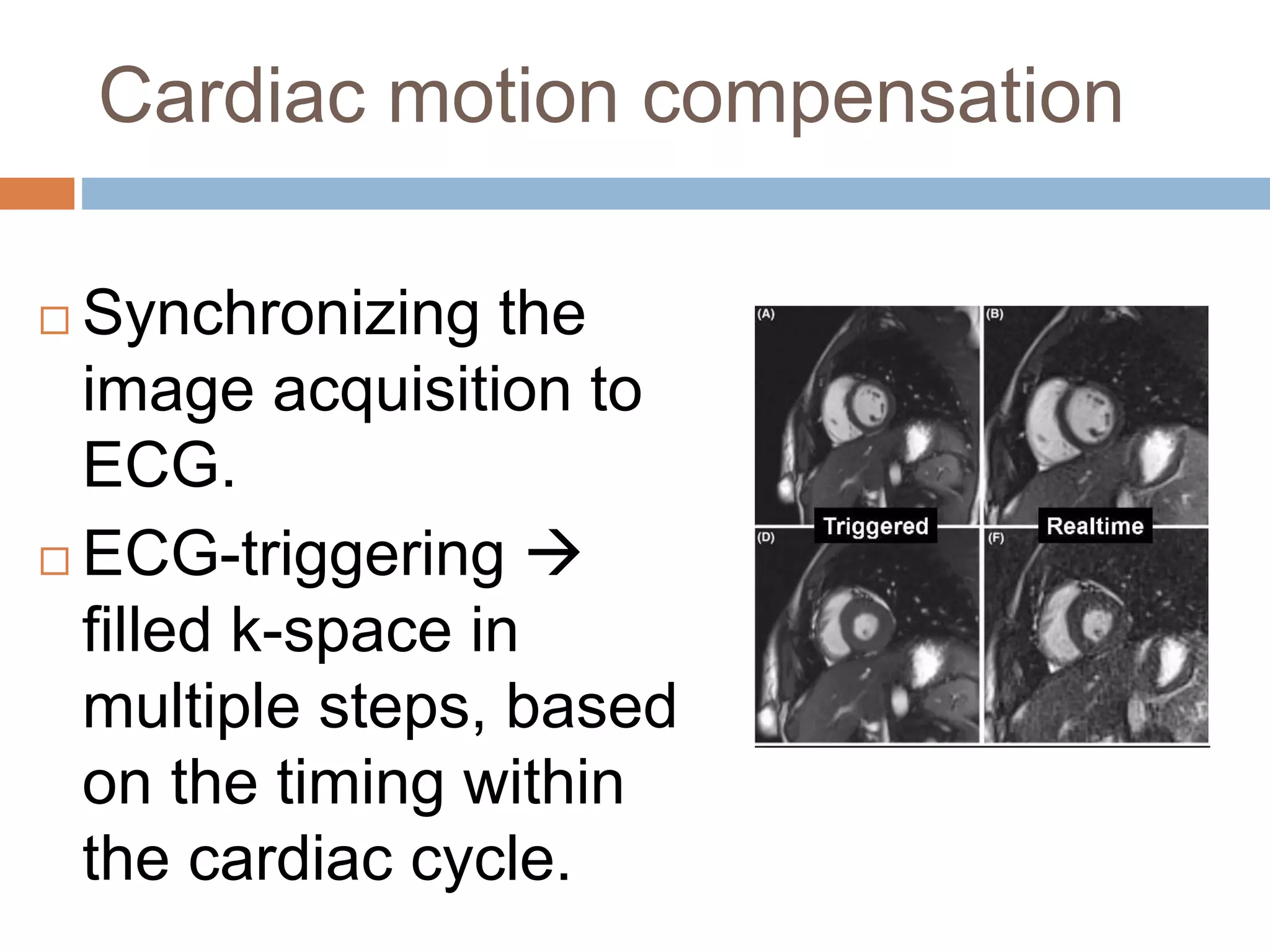 Cardiac MRI principle | PPTX