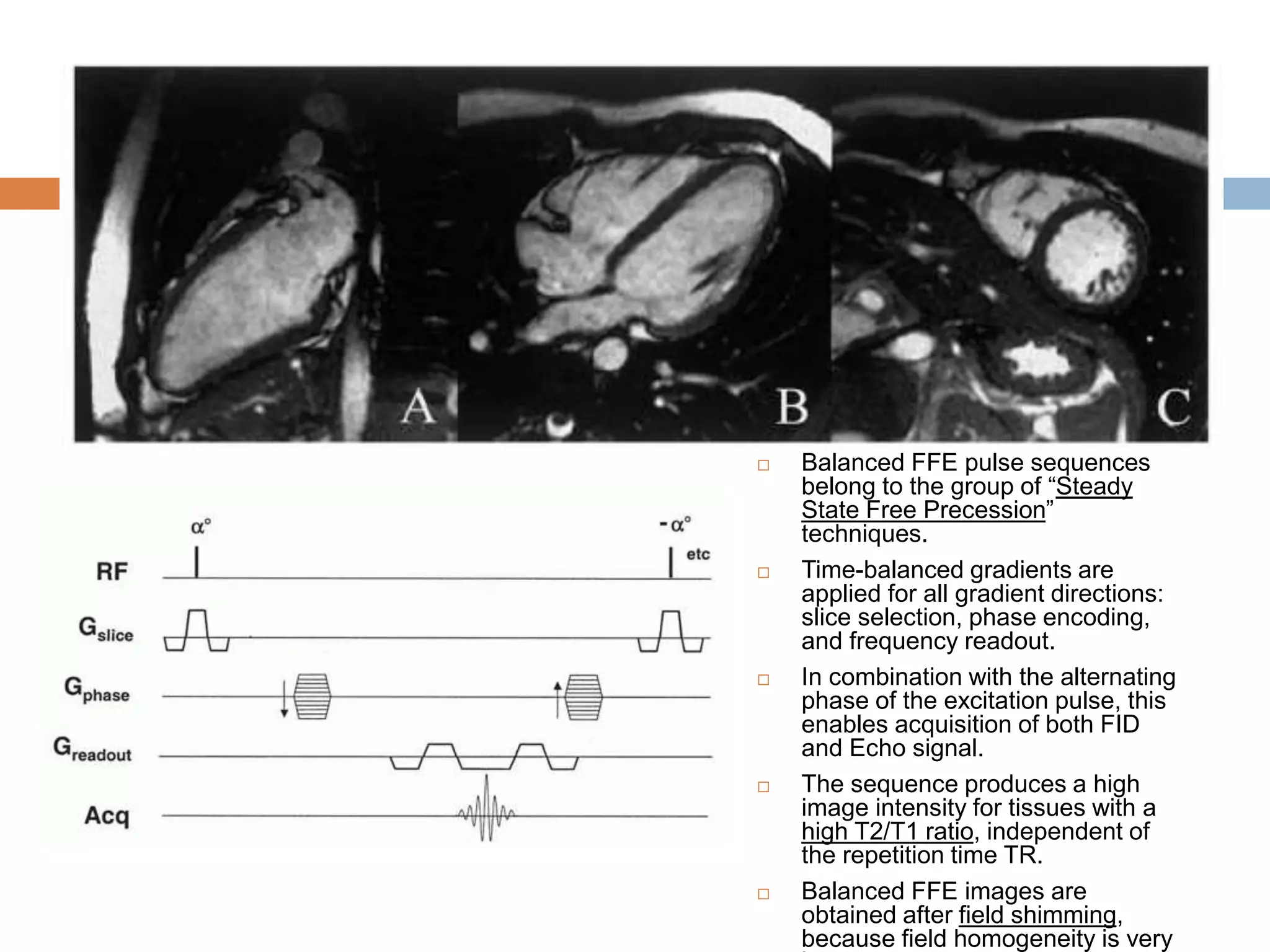 Cardiac MRI principle | PPTX