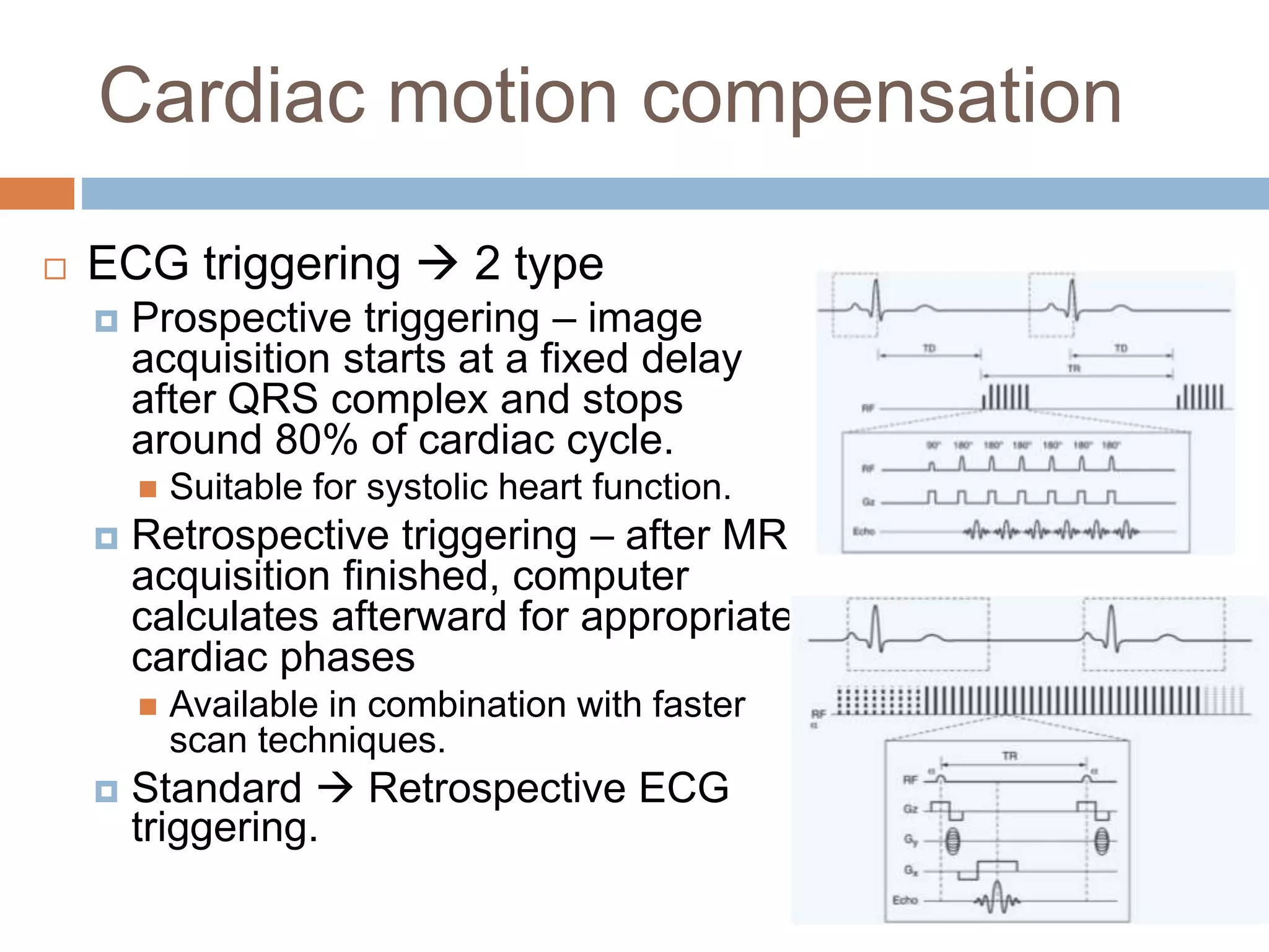 Cardiac MRI principle | PPTX