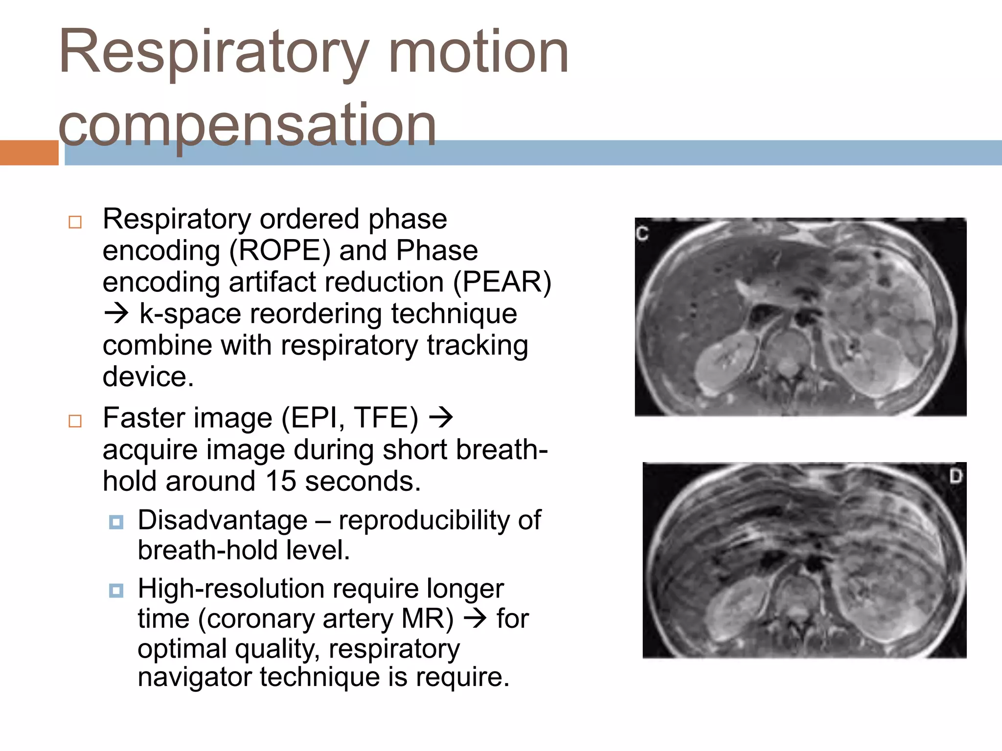 Cardiac MRI principle | PPTX