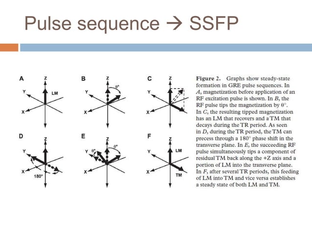 Cardiac MRI principle | PPTX | Heart and Cardiovascular Diseases ...