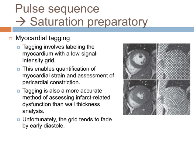 Cardiac MRI principle | PPTX | Heart and Cardiovascular Diseases ...