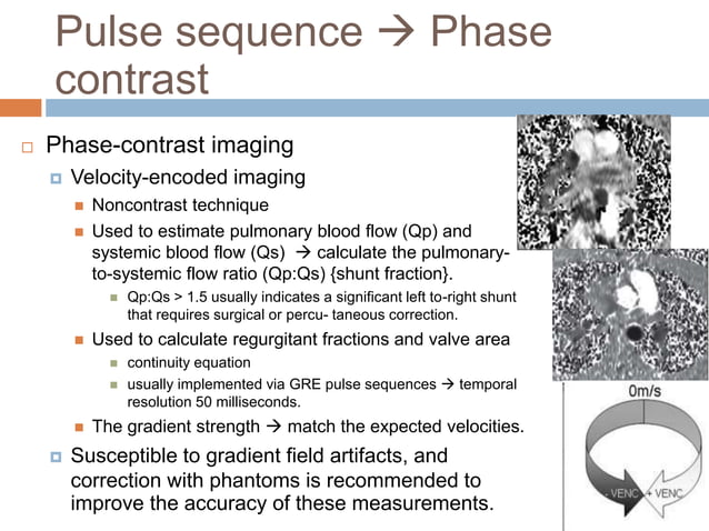 Cardiac MRI principle | PPTX | Heart and Cardiovascular Diseases ...