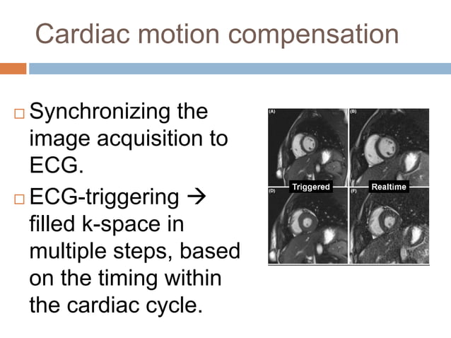 Cardiac MRI principle | PPTX | Heart and Cardiovascular Diseases ...