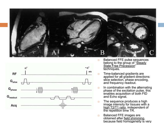 Cardiac MRI principle | PPTX | Heart and Cardiovascular Diseases ...