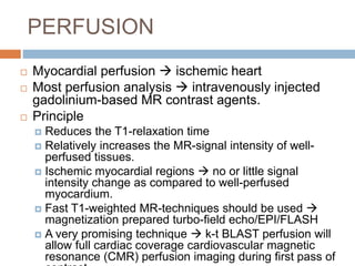 Cardiac MRI principle | PPTX