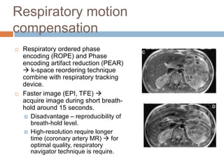 Cardiac MRI principle | PPTX