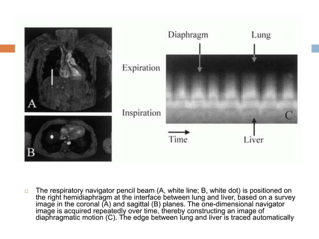 Cardiac MRI principle | PPTX | Heart and Cardiovascular Diseases ...