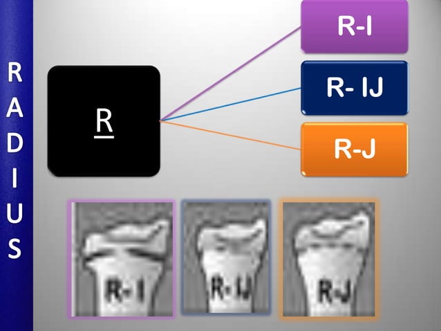 CVM staging and handwrist radiographs | PPTX | Bone and Joint ...