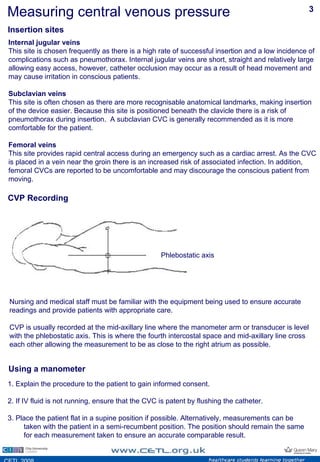 Cvp | PDF