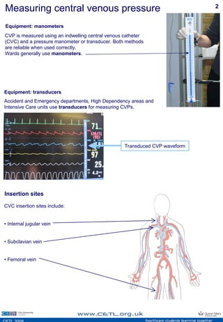 Measuring Central Venous Pressure