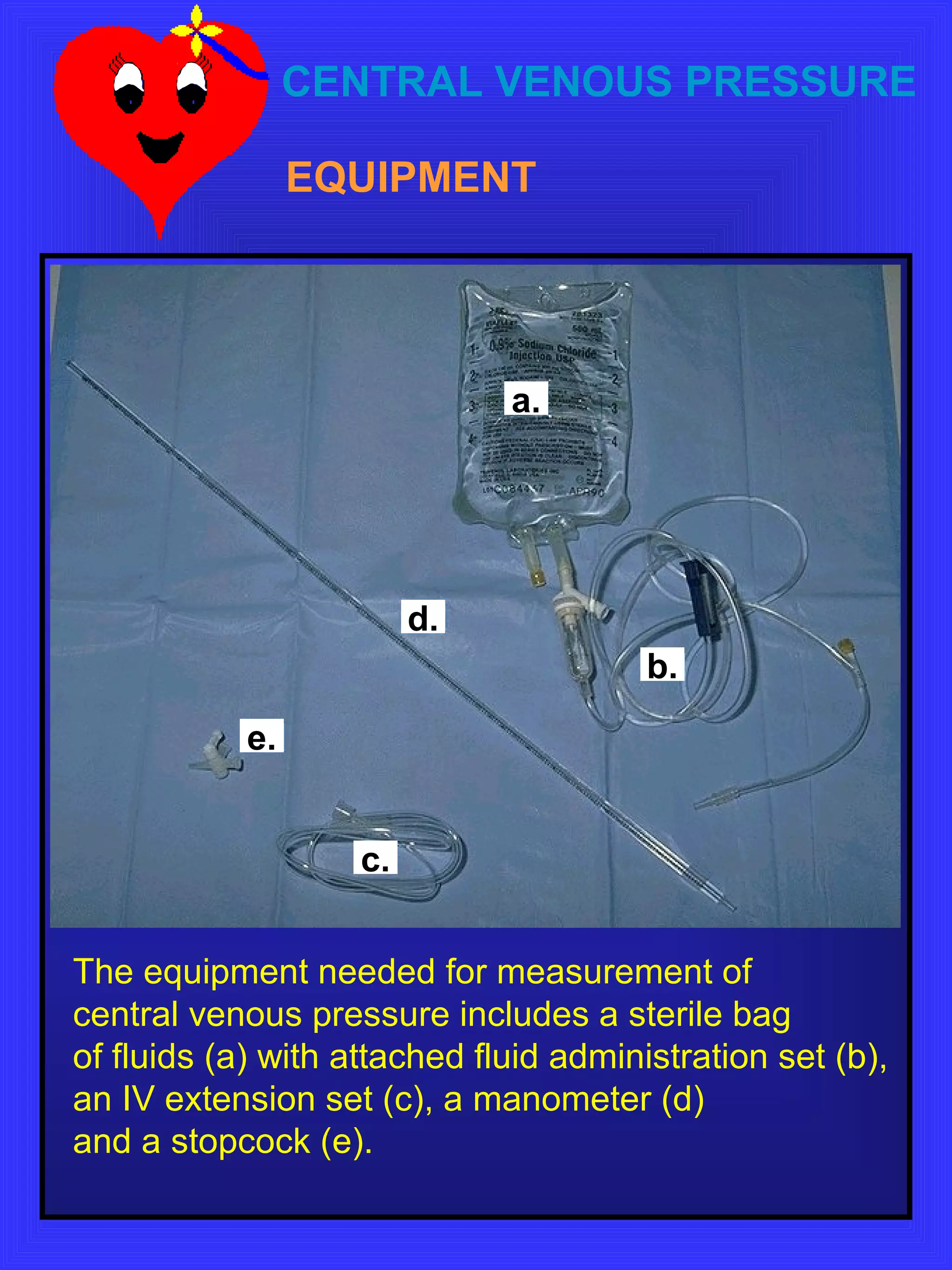 Cvp | PPT | Heart and Cardiovascular Diseases | Diseases and Conditions