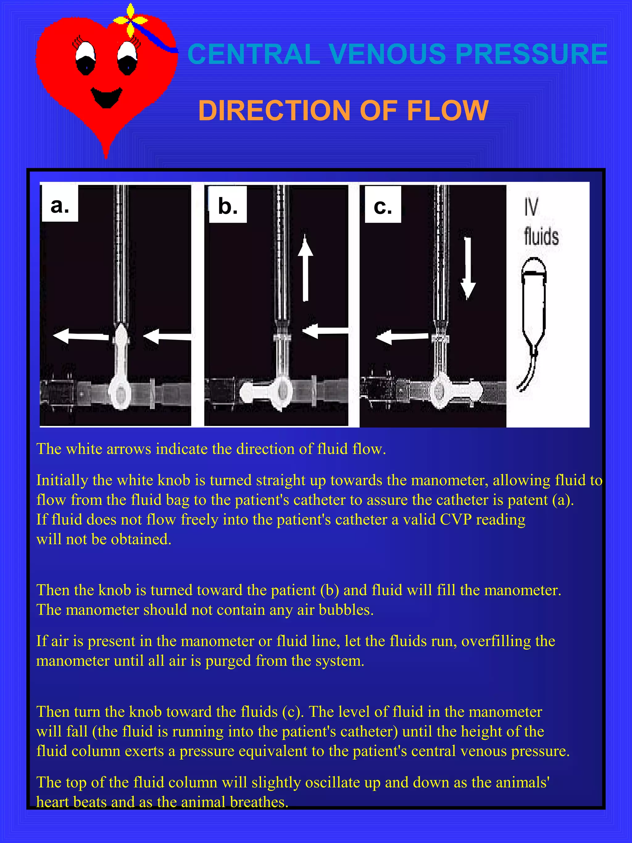 Cvp | PPT | Heart and Cardiovascular Diseases | Diseases and Conditions