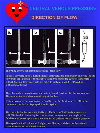 Cvp | PPT | Heart and Cardiovascular Diseases | Diseases and Conditions