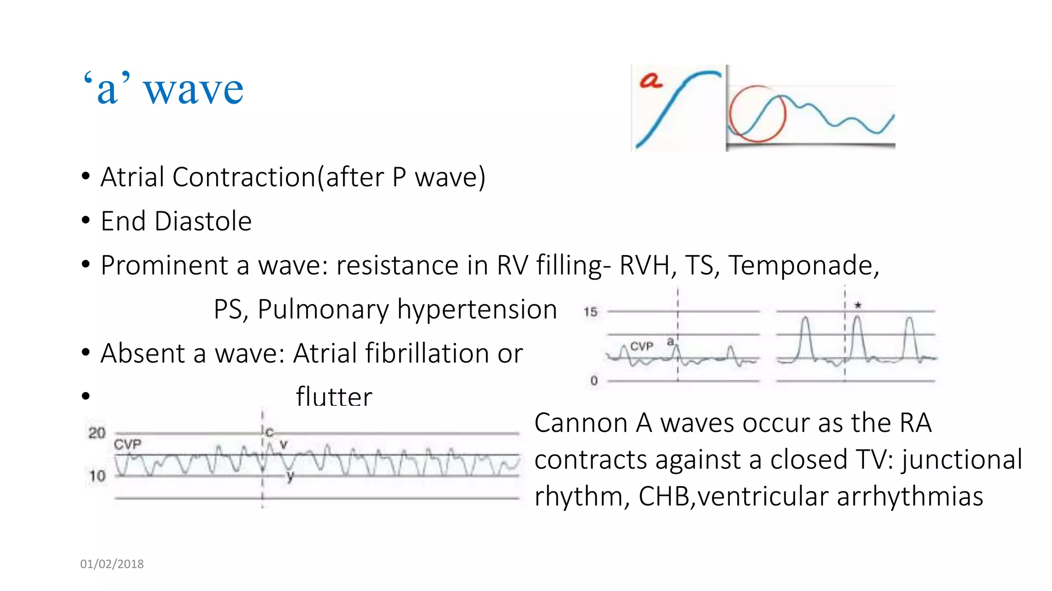 CENTRAL VENOUS PRESSURE MONITORING- IACTACON 2018 | PPTX