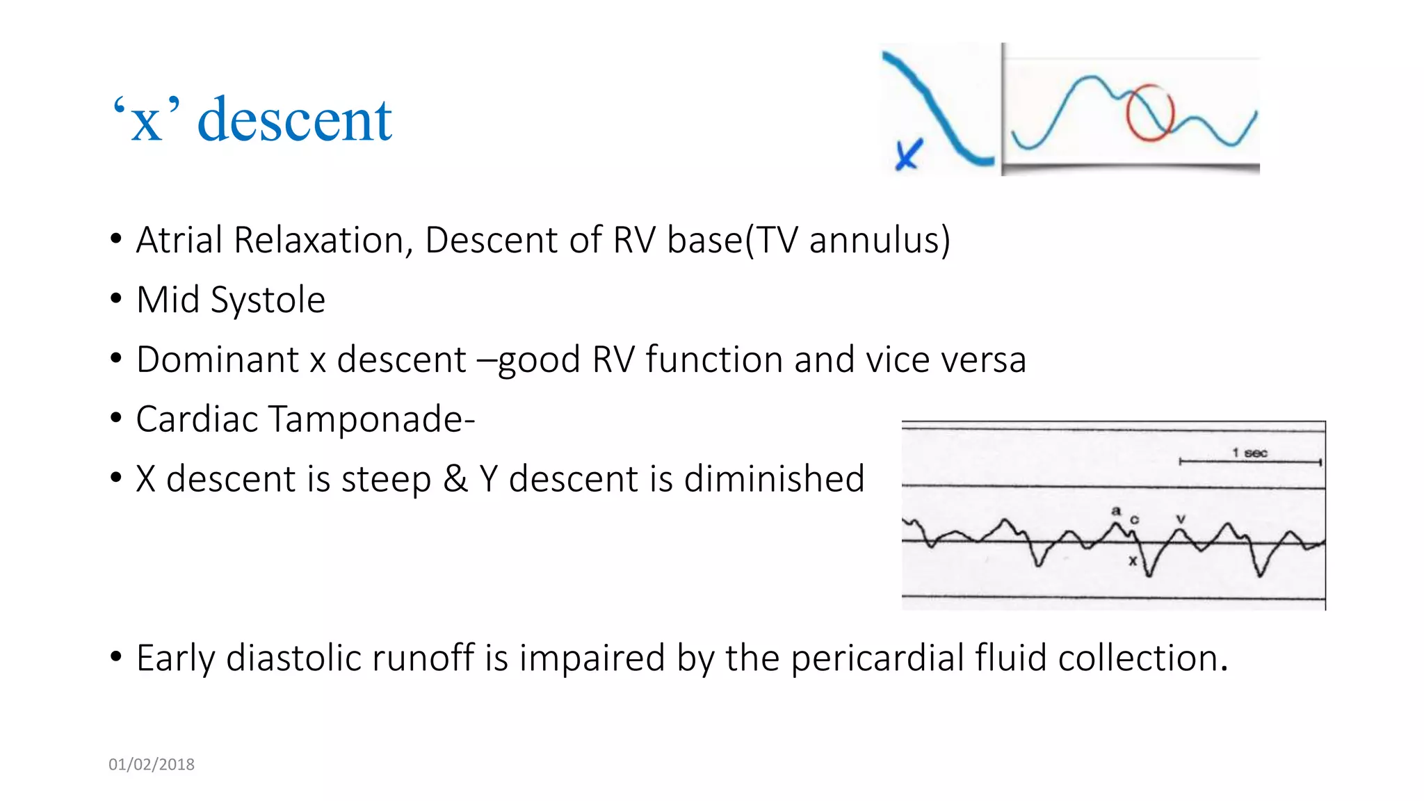 CENTRAL VENOUS PRESSURE MONITORING- IACTACON 2018 | PPTX