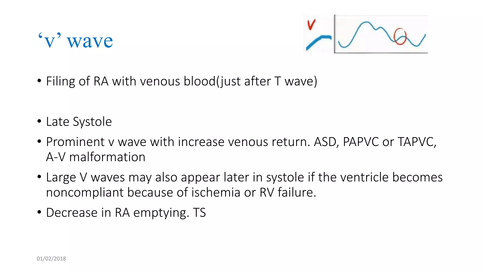CENTRAL VENOUS PRESSURE MONITORING- IACTACON 2018 | PPTX