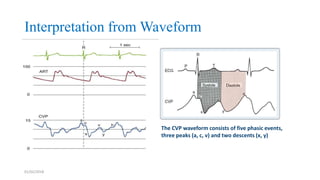 CENTRAL VENOUS PRESSURE MONITORING- IACTACON 2018 | PPTX