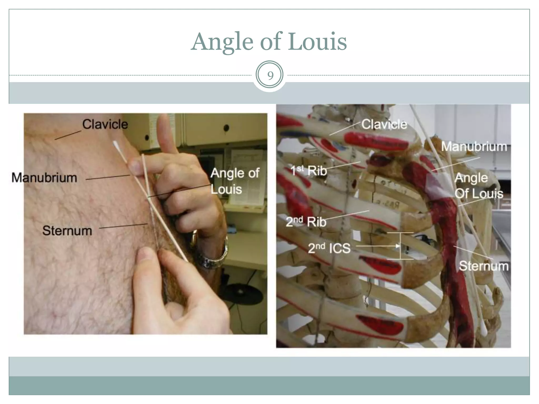 Cv physical exam - Gabriel | PPTX | Heart and Cardiovascular Diseases | Diseases and Conditions
