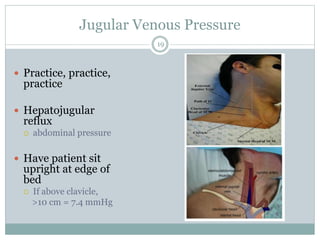 Cv physical exam - Gabriel | PPTX
