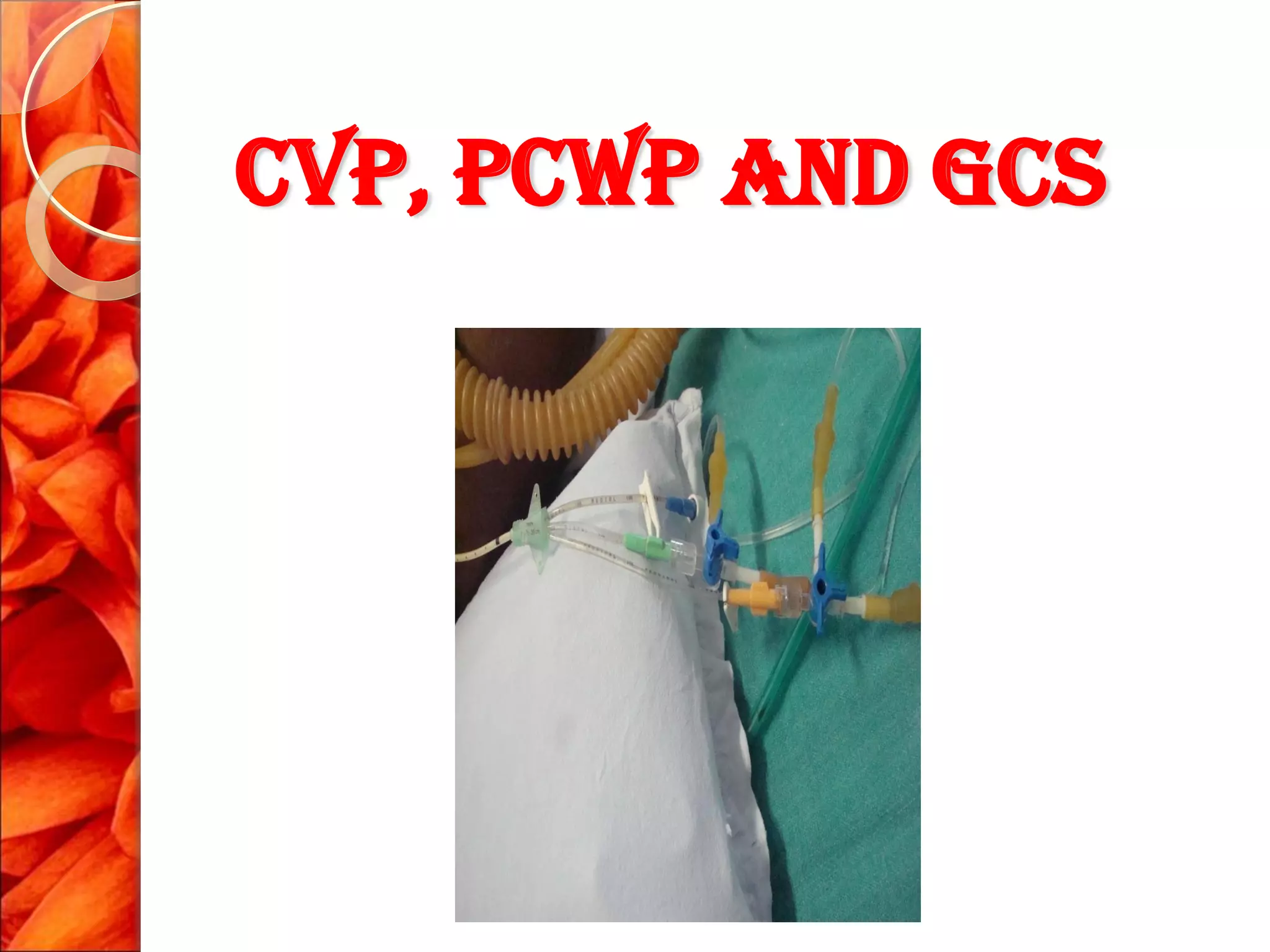 Cvp line | PDF