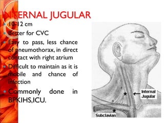 Cvp line | PDF