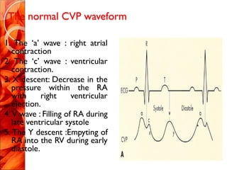 Cvp line | PDF