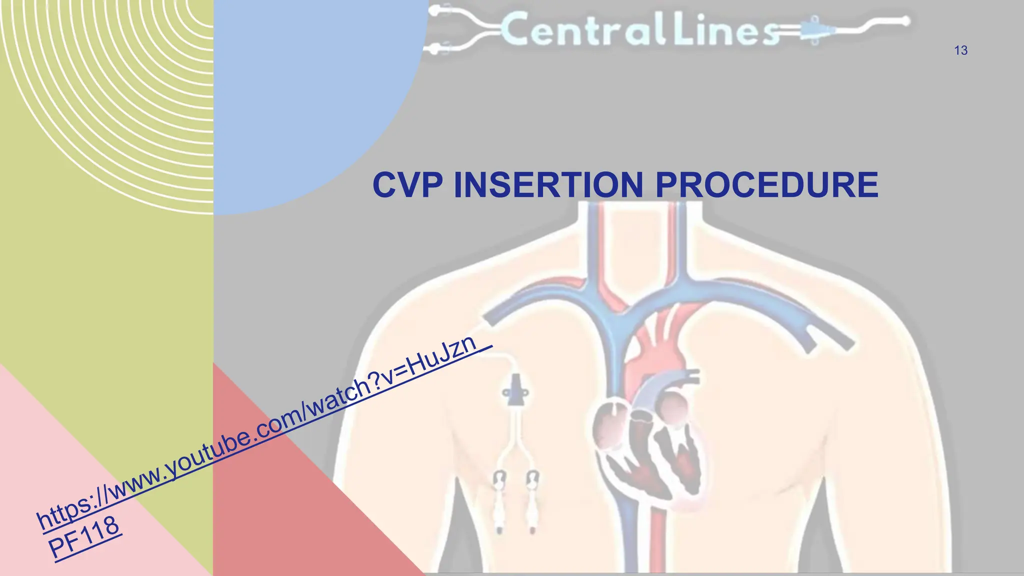 Care of CVP line .pptx
