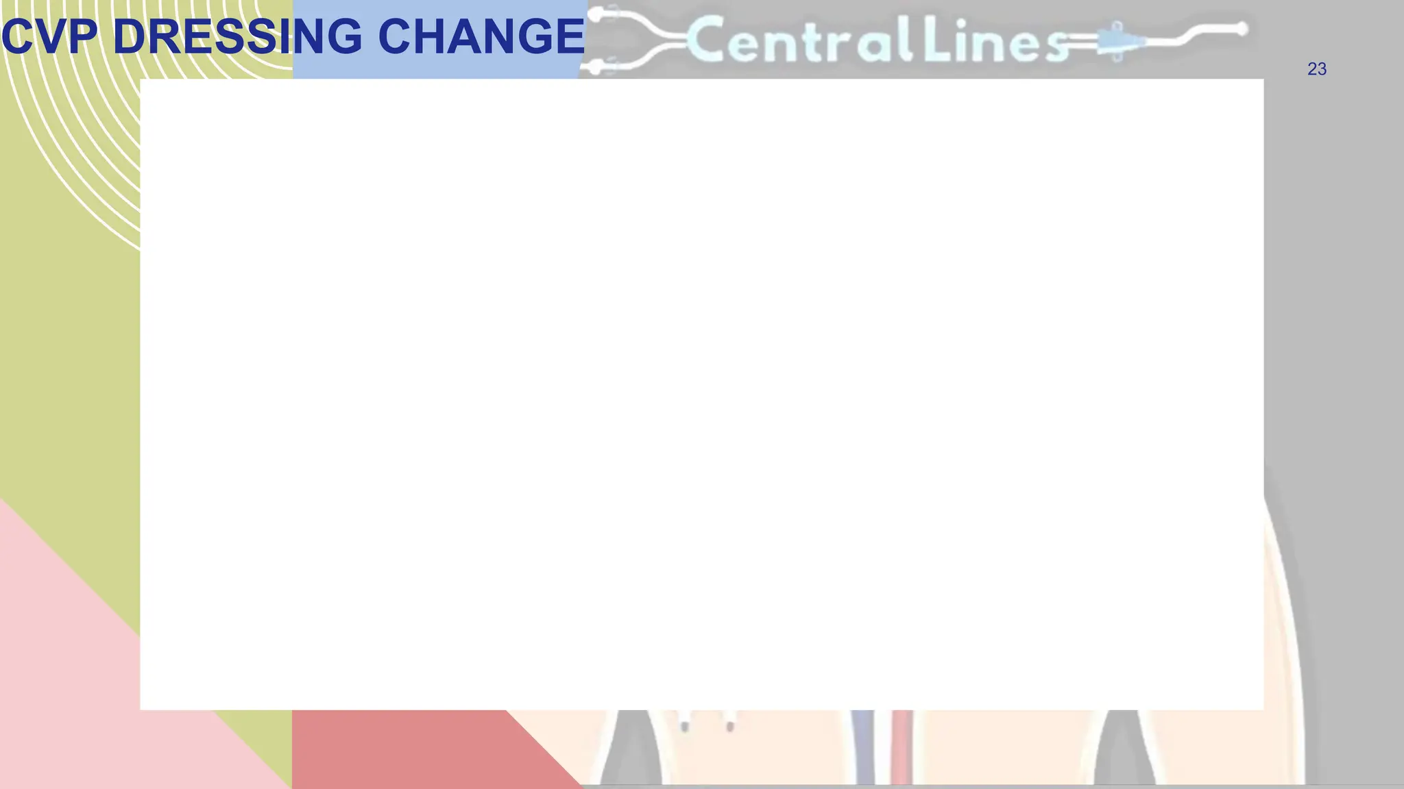 Care of CVP line .pptx