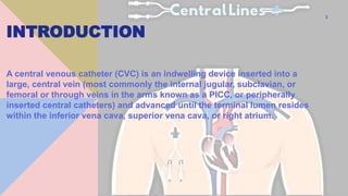 Care of CVP line .pptx