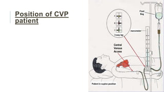 CVP micro teaching.pptx