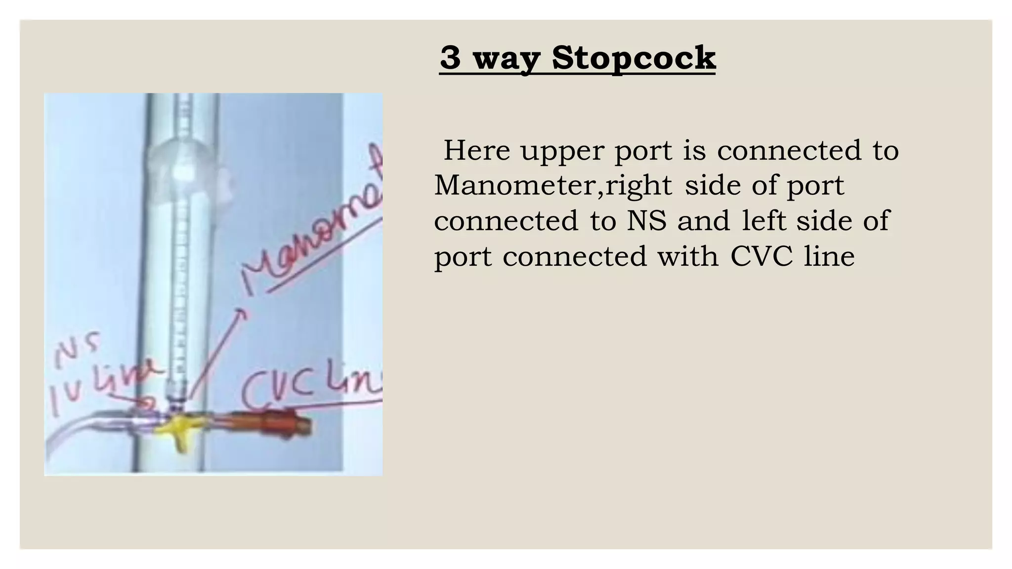 cvp monitoring | PDF