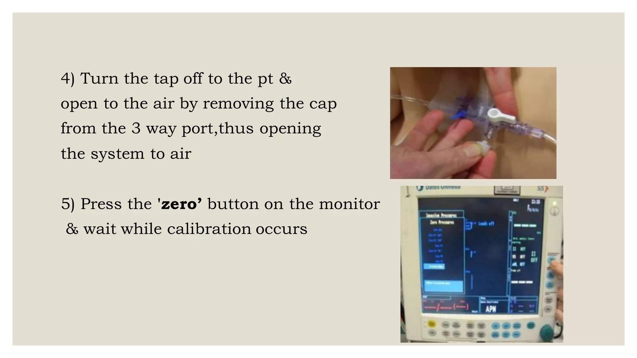 cvp monitoring | PDF