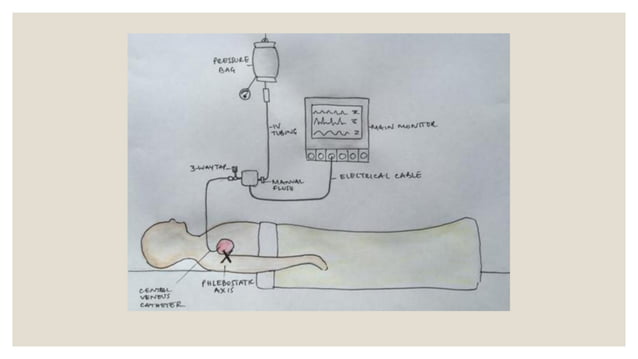 cvp monitoring | PDF