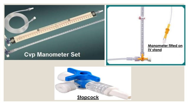 cvp monitoring | PDF