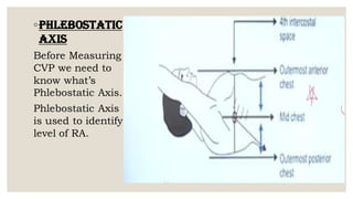 cvp monitoring | PPT