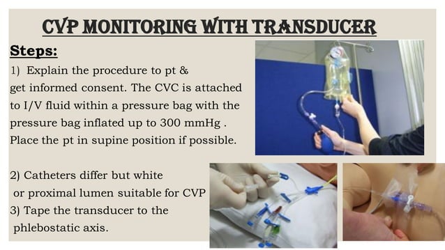 cvp monitoring | PDF