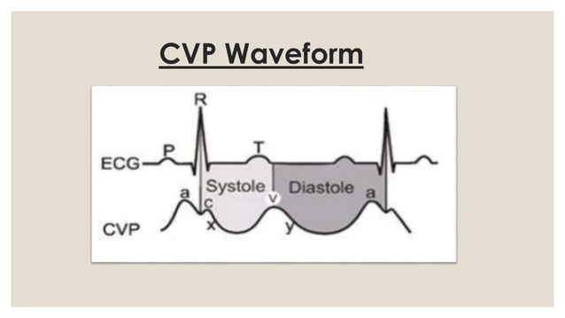 cvp monitoring | PDF