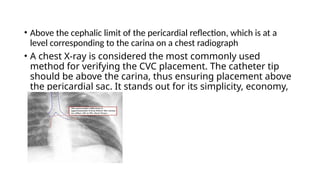 Central venous pressures pac catheters ppt | PPTX
