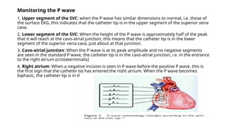 Central venous pressures pac catheters ppt | PPTX