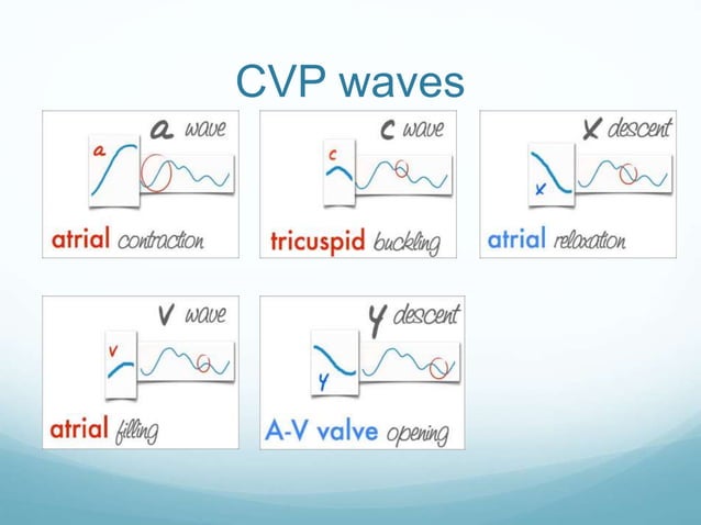 CVP Pulmonary artery wedge pressure monitoring: Physiology | PPSX