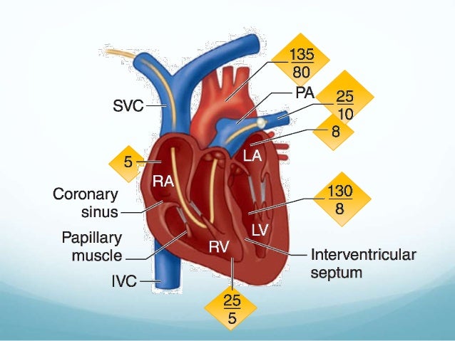 CVP Pulmonary artery wedge pressure monitoring: Physiology