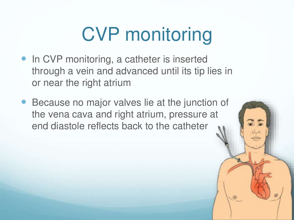 CVP Pulmonary Artery Wedge Pressure Monitoring Physiology cvp-pulmonary-artery-wedge-pressure-monitoring-physiology